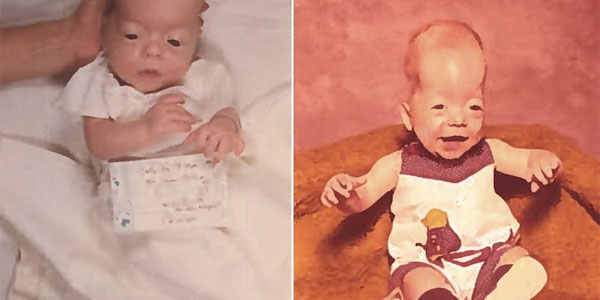 Baby Born Without Brain Gets Healed – 海外华人福音网